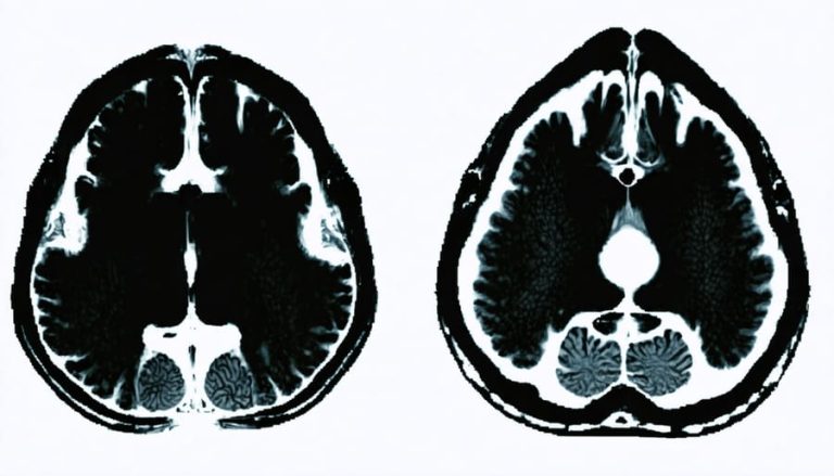 How Critical Early Vision Shapes Your Child's Brain Development - Kids ...